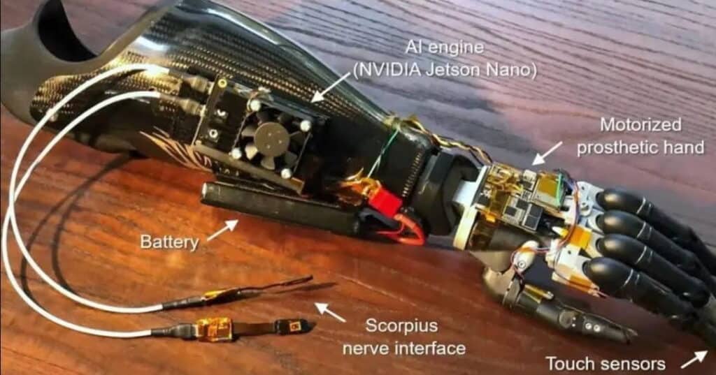 Una prótesis de mano robótica que tiene tacto y funciona con la mente ...