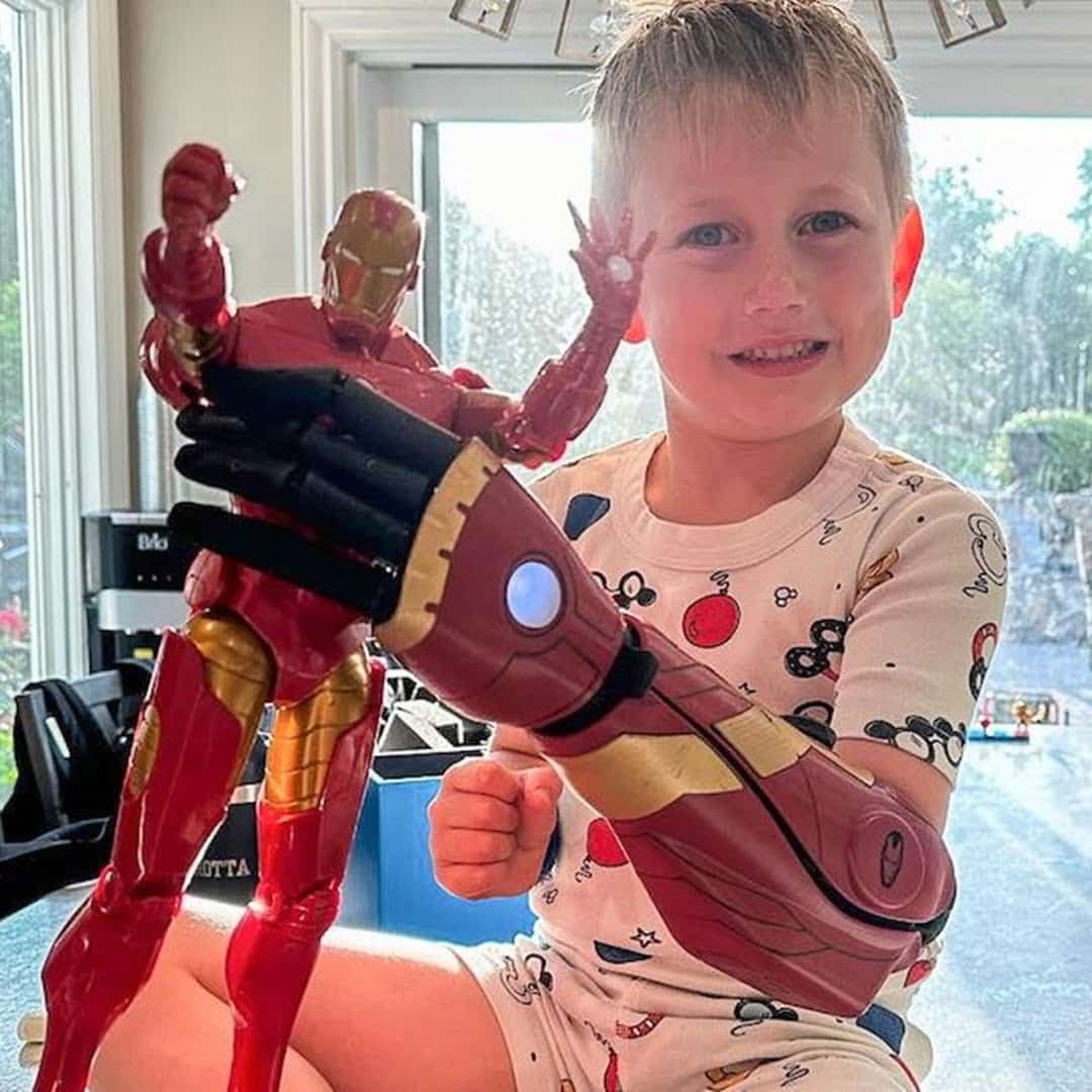 Con 5 Años De Edad, Jordan Marotta Recibe Un Brazo Biónico
